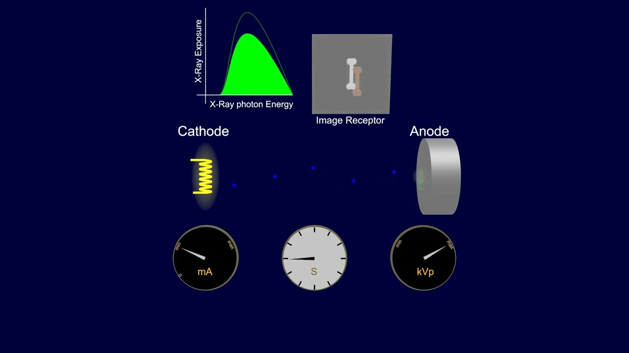 Radiological Sciences Student Project: The exposure time and tube ...