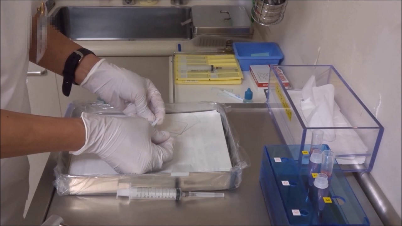 Thyroid FNA (standard) - YouTube