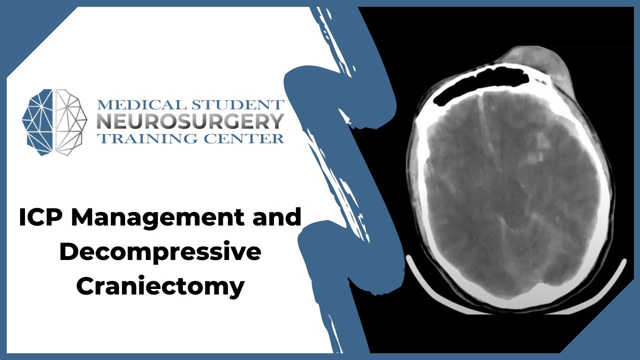 ICP Management and Decompressive Craniectomy - YouTube