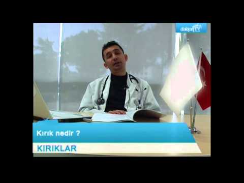 Kırık nedir?