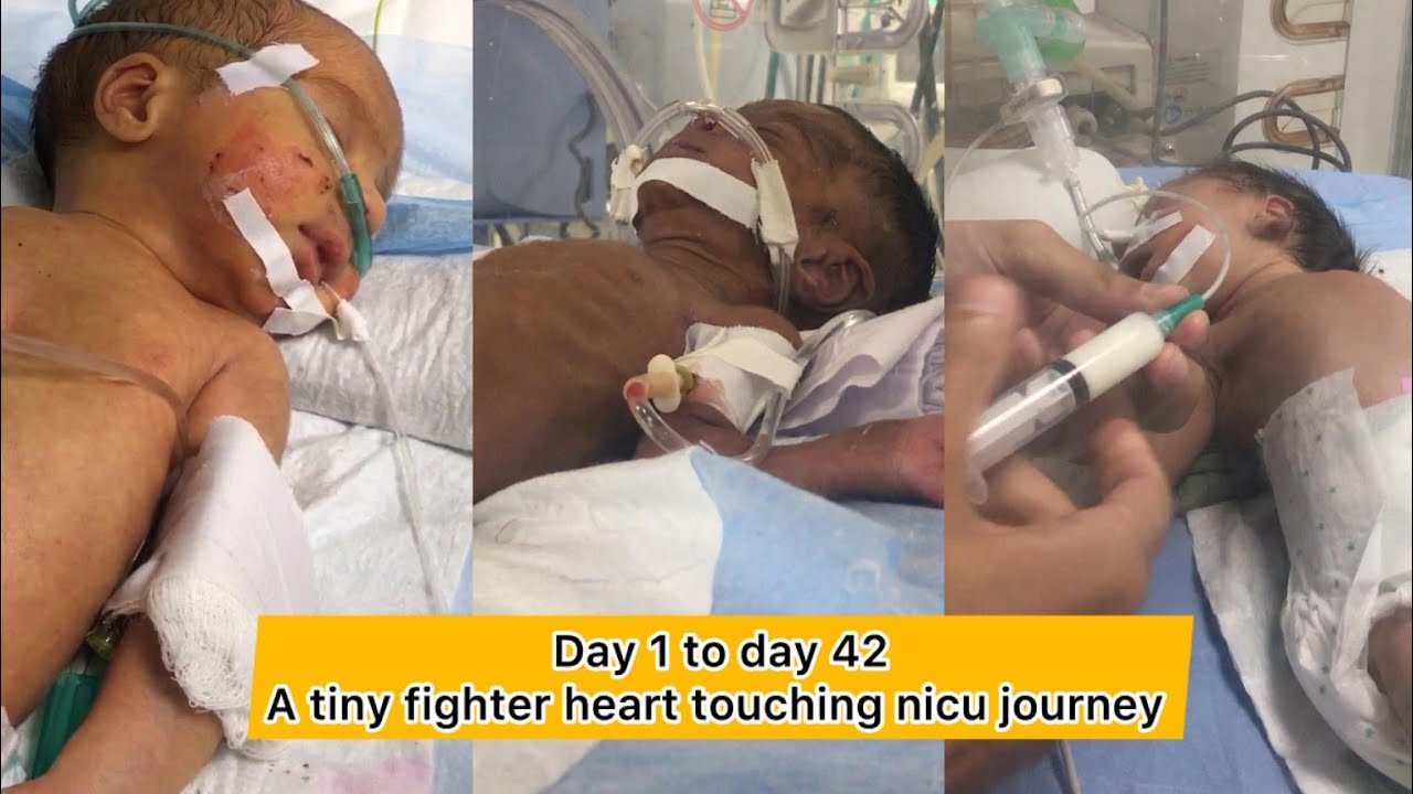 Day 1 to 42 — The Heart-Touching Journey of a NICU Baby 💞 - YouTube