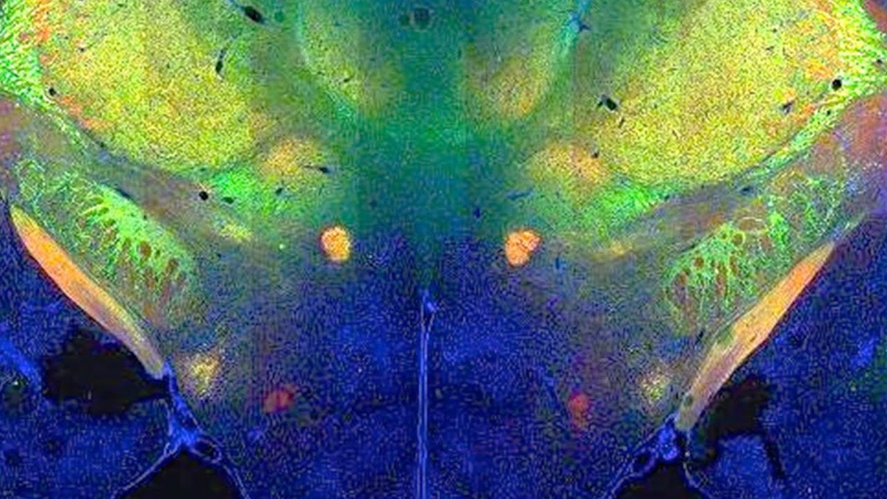 Richard Palmiter: 2011 Allen Institute for Brain Science Symposium ...