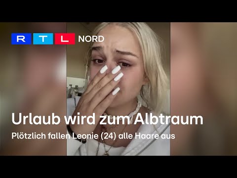 Plötzlich Haarausfall! Leonie (24) leidet an Alopecia areata