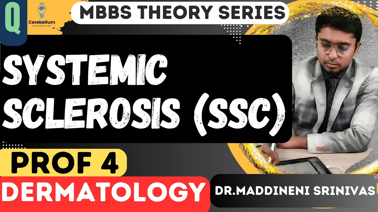 Systemic Sclerosis | MBBS 4th Year Dermatology Theory Question and ...