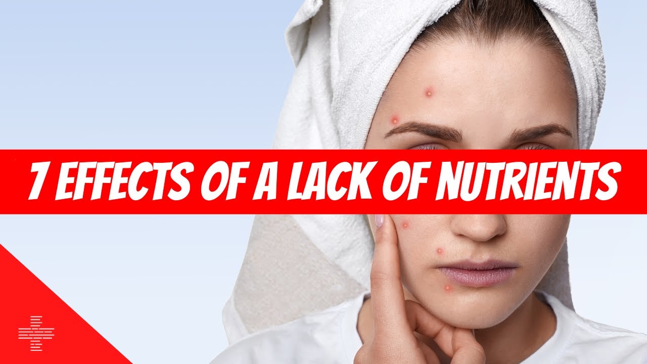 7 Effects of a Lack of Nutrients - YouTube