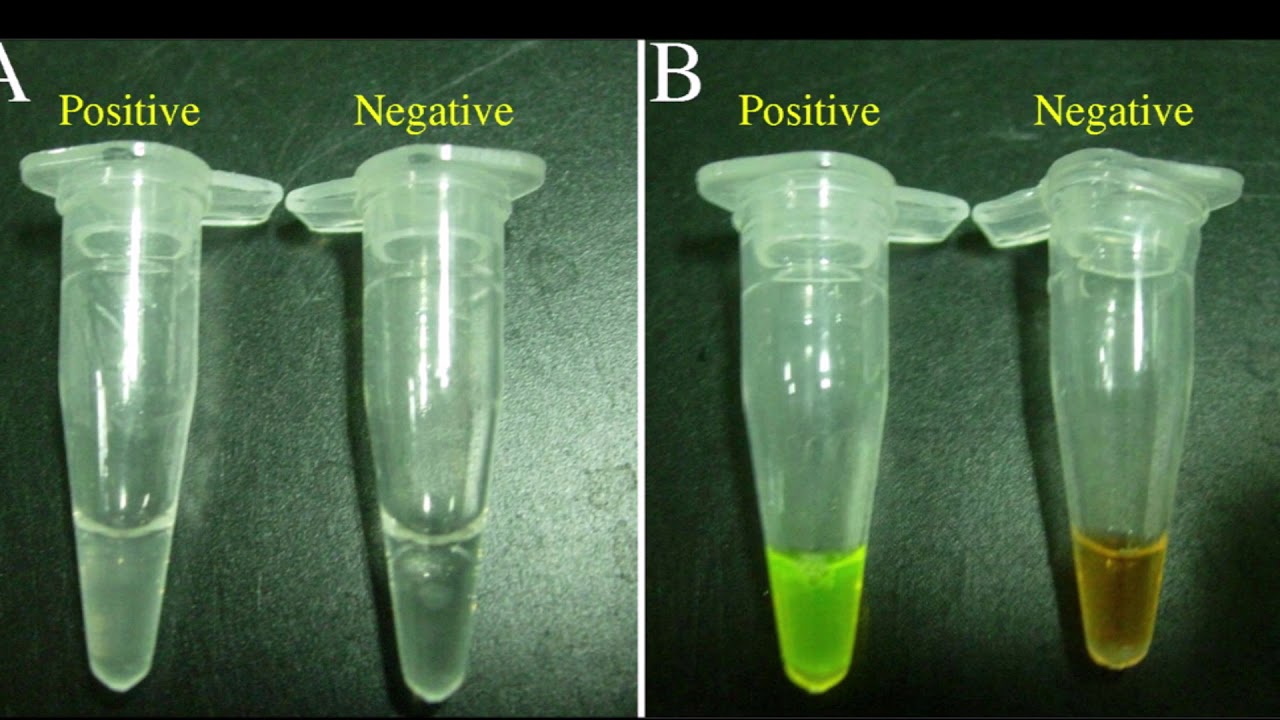 RT LAMP mediated SARS CoV-2 Detection Kit - YouTube