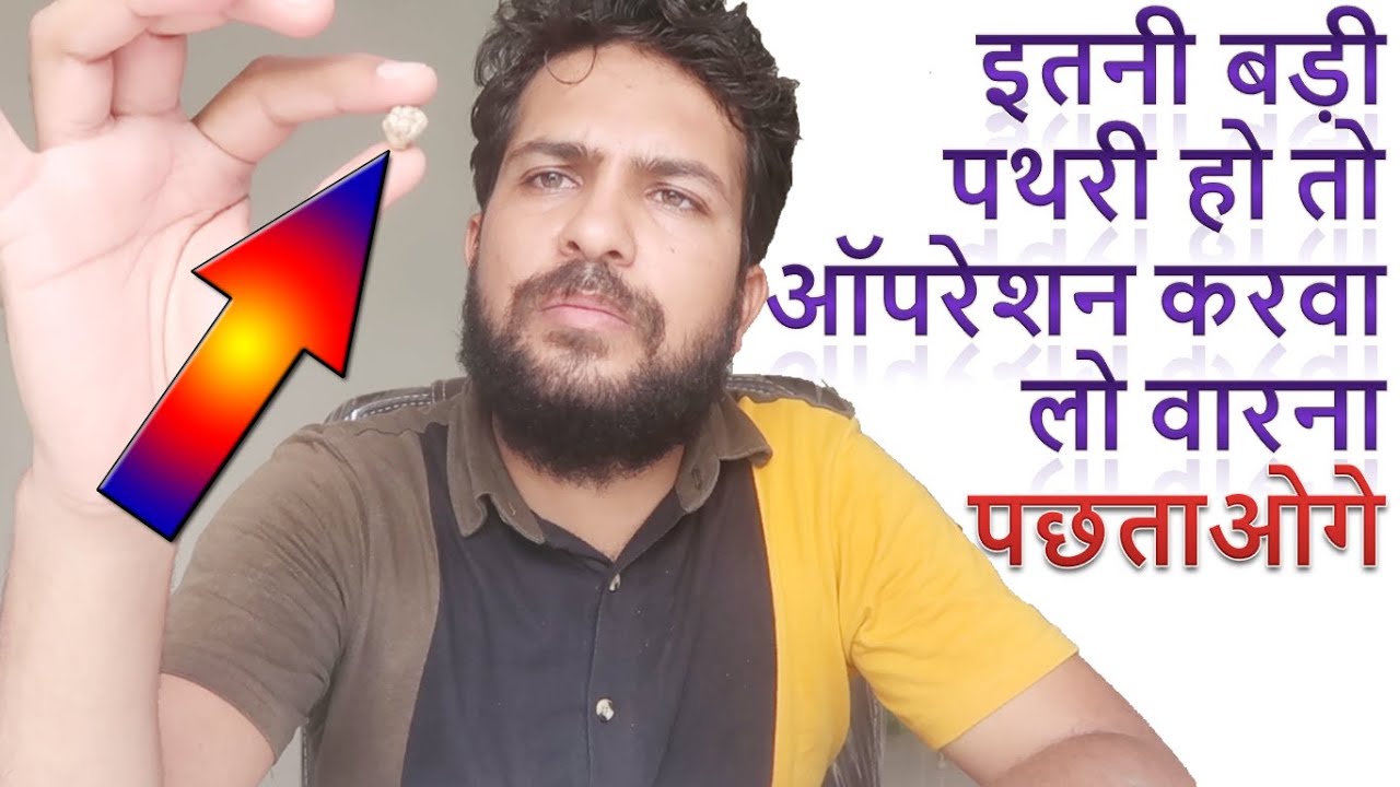Pathri ka operation kab aur kitni badi pathari ho tab karna chahiye ...