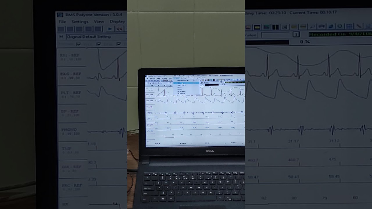 RMS multiple channel physiograph demo. - YouTube