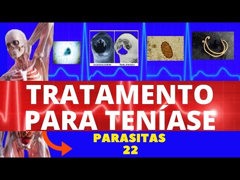 TRATAMENTO PARA TENÍASE (TAENIA SOLIUM TAENIA SARGINATA) - PARASITOLOGIA | INFECTOLOGIA