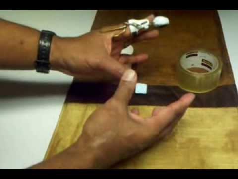 Prosthetic Finger - YouTube
