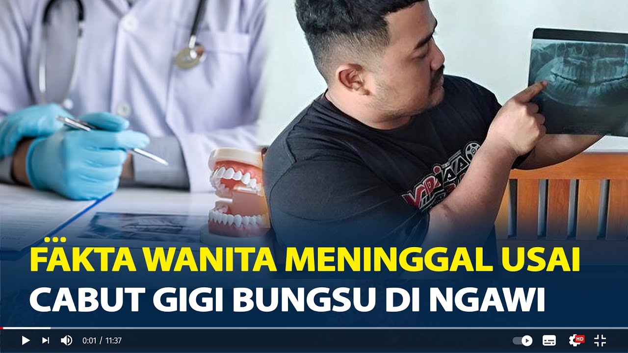Fakta Wanita Meninggal Usai Cabut Gigi Bungsu di Ngawi, Habiskan Rp 500 ...