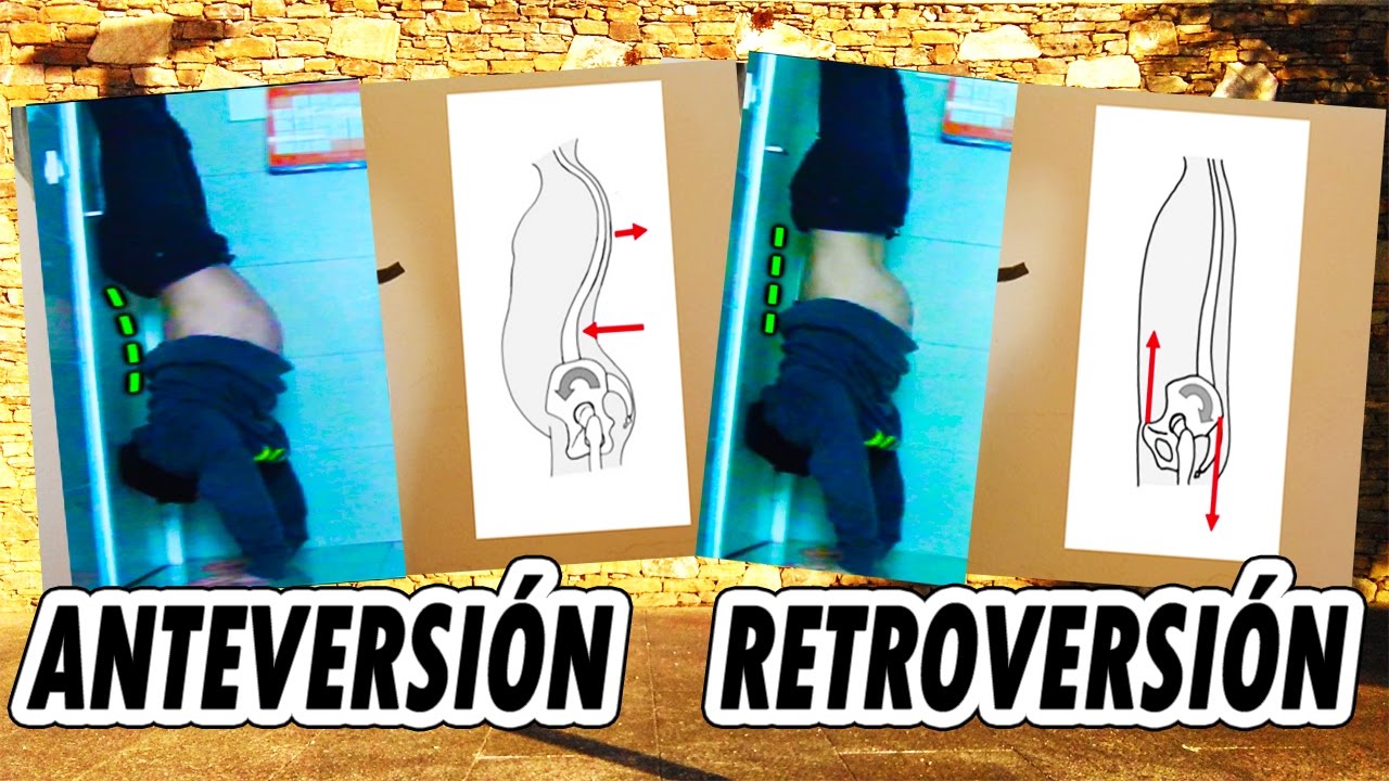 RETROVERSIÓN Y ANTEVERSIÓN PELVICA - COMO USARLA EN POWERMOVE - YouTube