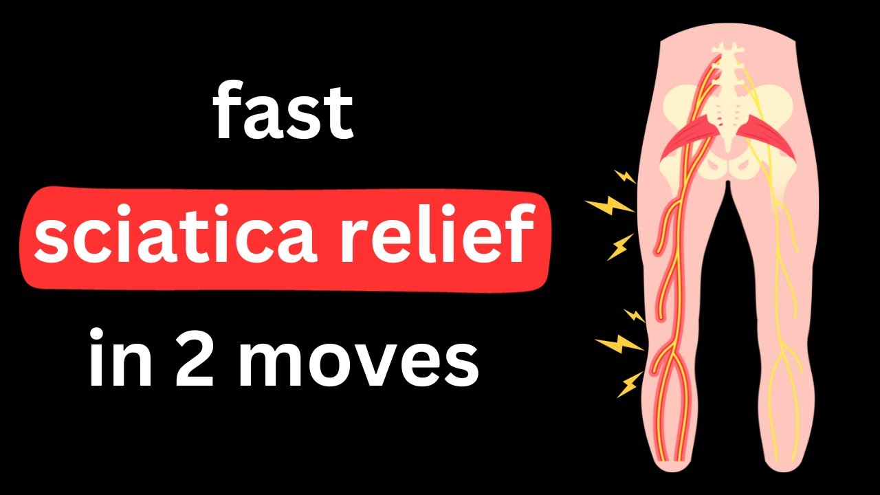 What Is Sciatica + How To Get Rid Of it - 2 Simple Steps - YouTube