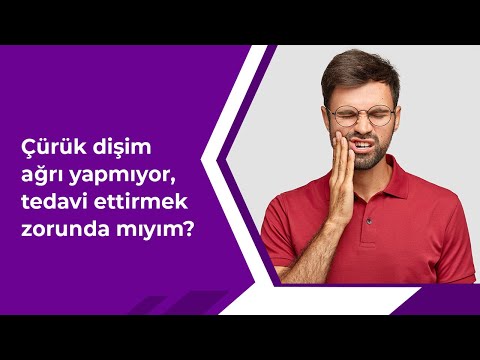 Çürük dişim ağrı yapmıyor, tedavi ettirmek zorunda mıyım?