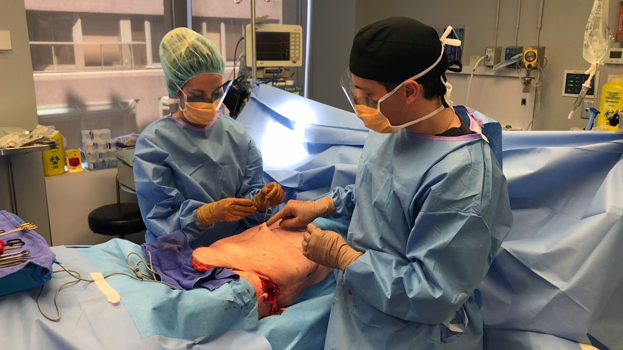 Full circumferential body lift with Dr. Daniel Guberman - YouTube