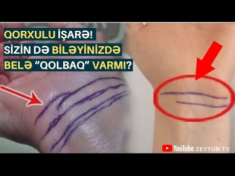 Qorxulu işarə! sizin də biləyinizdə belə “Qolbaq”varmı? əgər varsa, onun mənası budur!