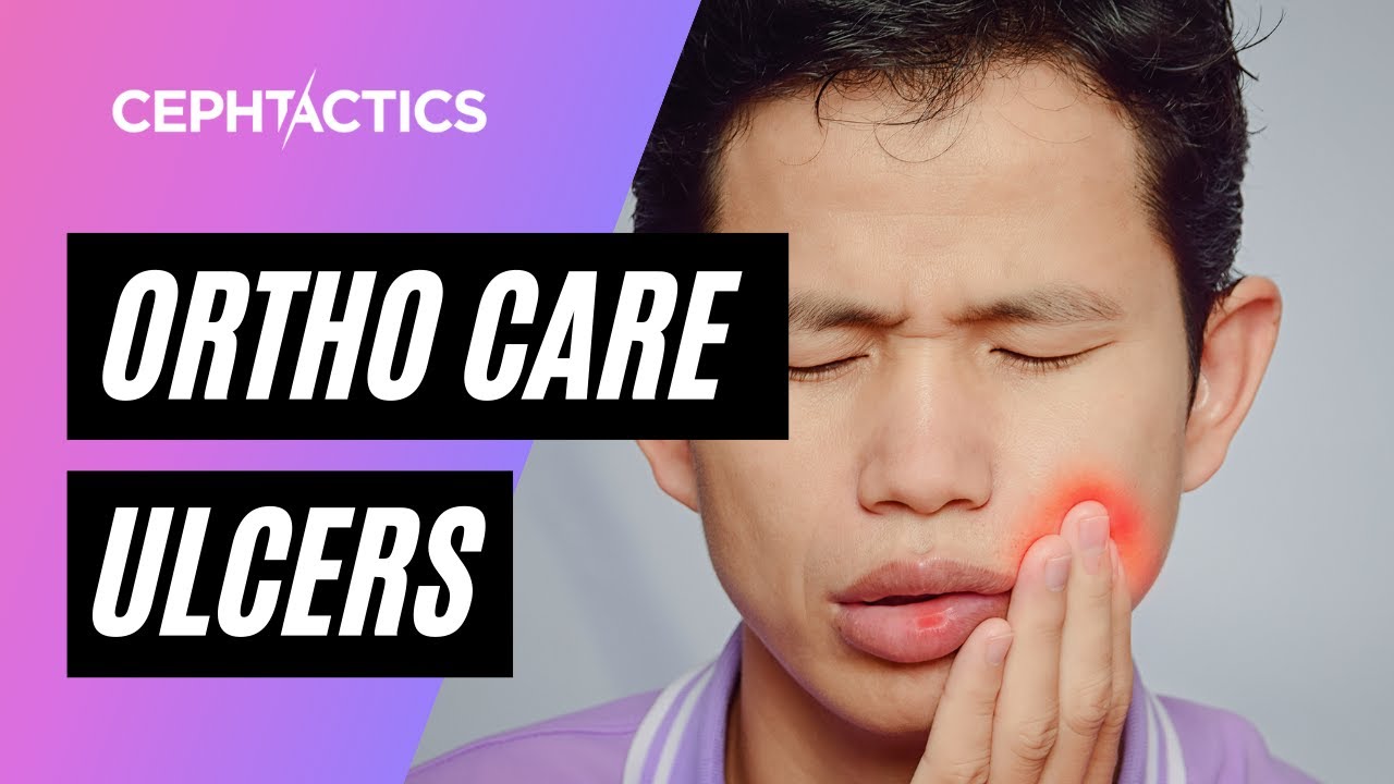 Ulcers - How to prevent them (Orthodontic Care) - YouTube