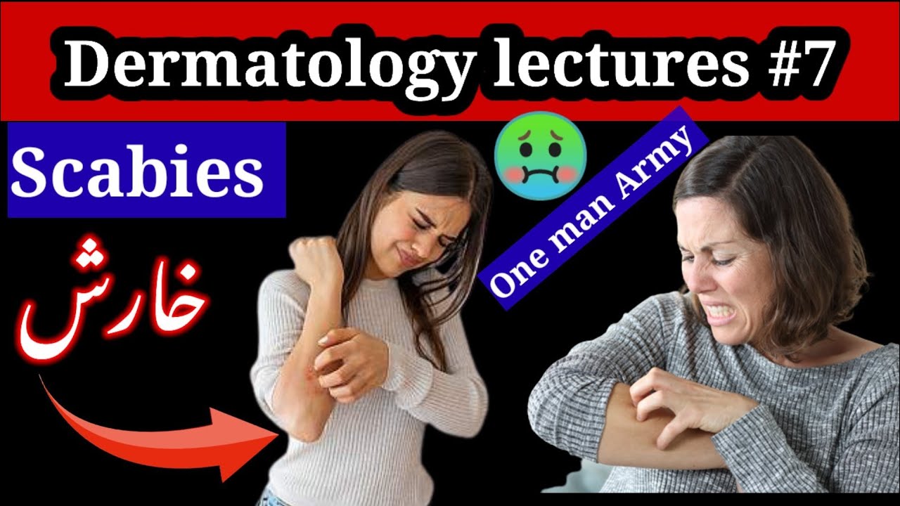 scabies dermatology lecture #7 // what is scabies. diagnosis and ...