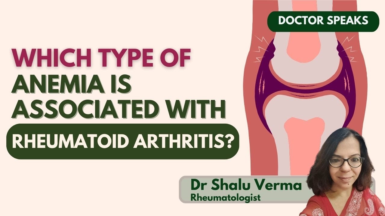 Which Type Of Anemia Is Associated With Rheumatoid Arthritis? - YouTube