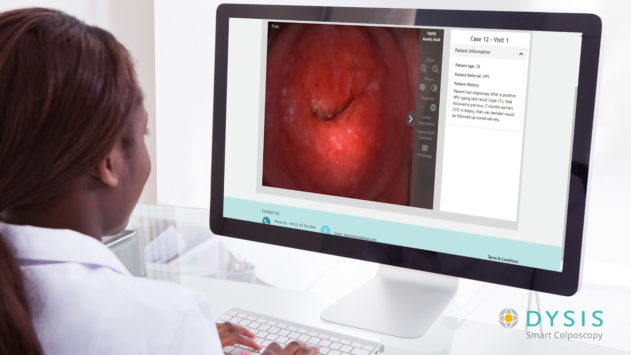 DYSIS Medical Colposcopy Skills - YouTube