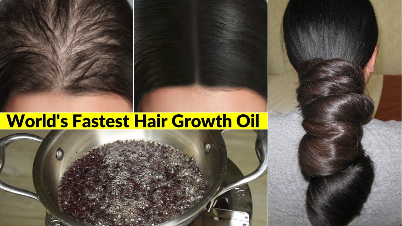 I tried👆World's Fastest Hair Growth Oil-For Unstoppable Hair Growth ...
