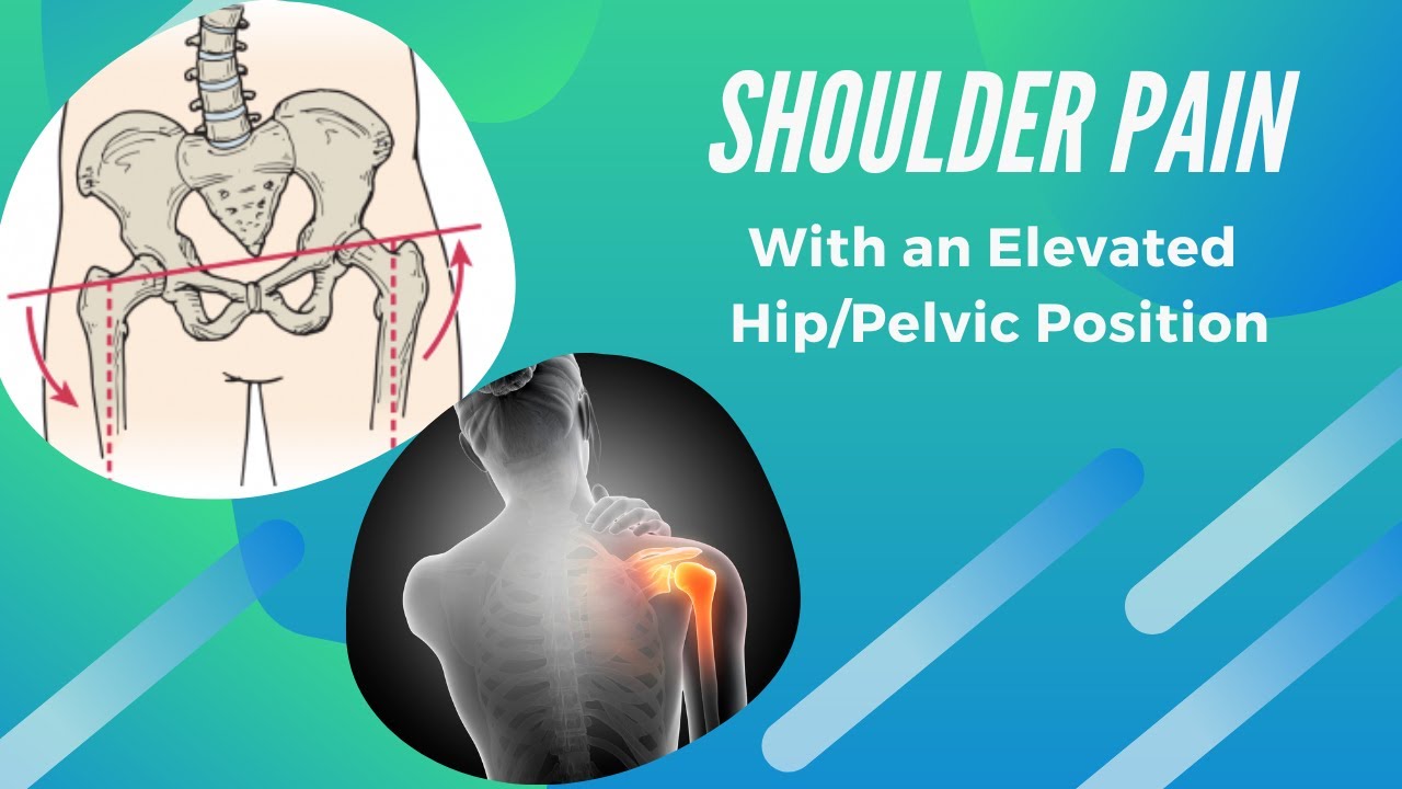 Exercises for Shoulder Pain with an Elevated Hip and Shoulder - YouTube