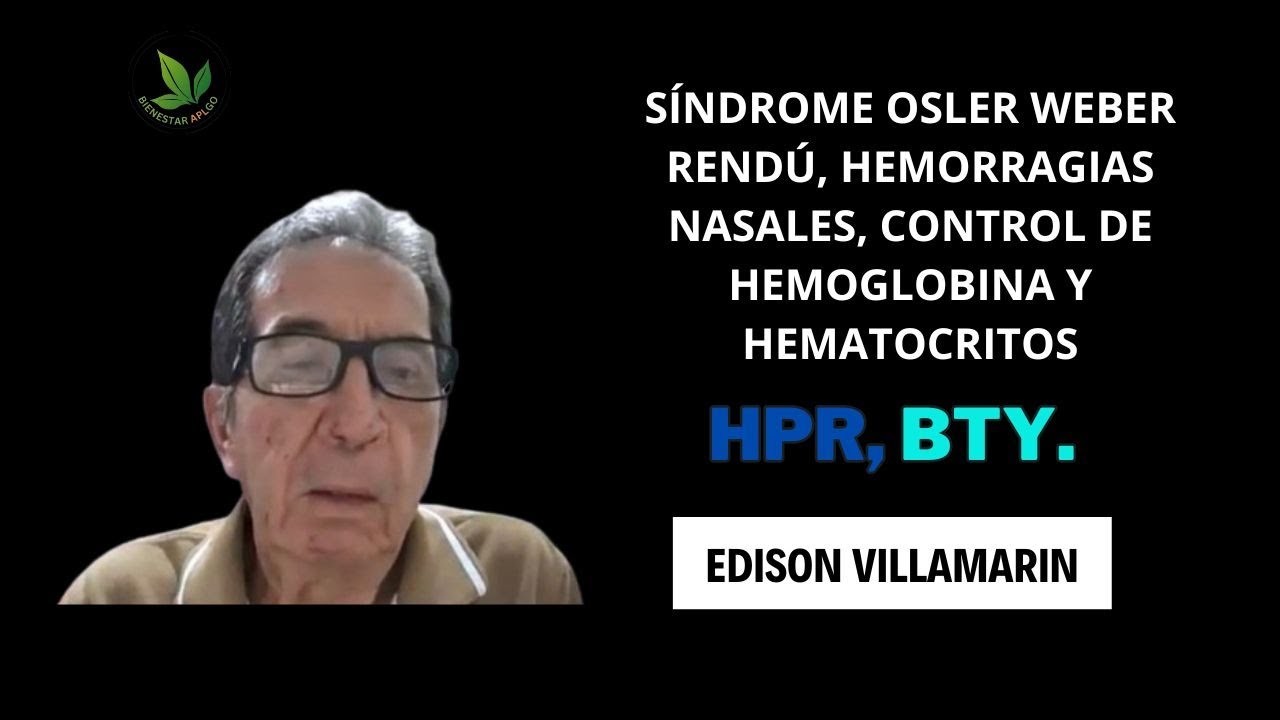 131. Síndrome Osler Weber Rendú, hemorragias nasales, control de ...