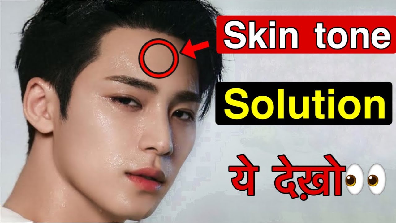 How To Get Rid Of Uneven Skin Tone For Men/Boy In Hindi|Uneven Skin ...