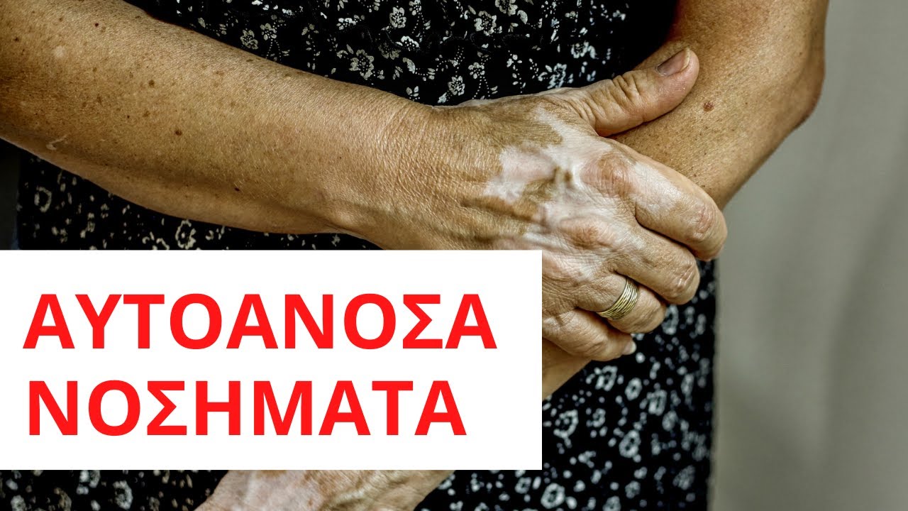 Διατροφή και ΑΥΤΟΑΝΟΣΑ νοσήματα: Όλα όσα πρέπει να γνωρίζεις! - YouTube