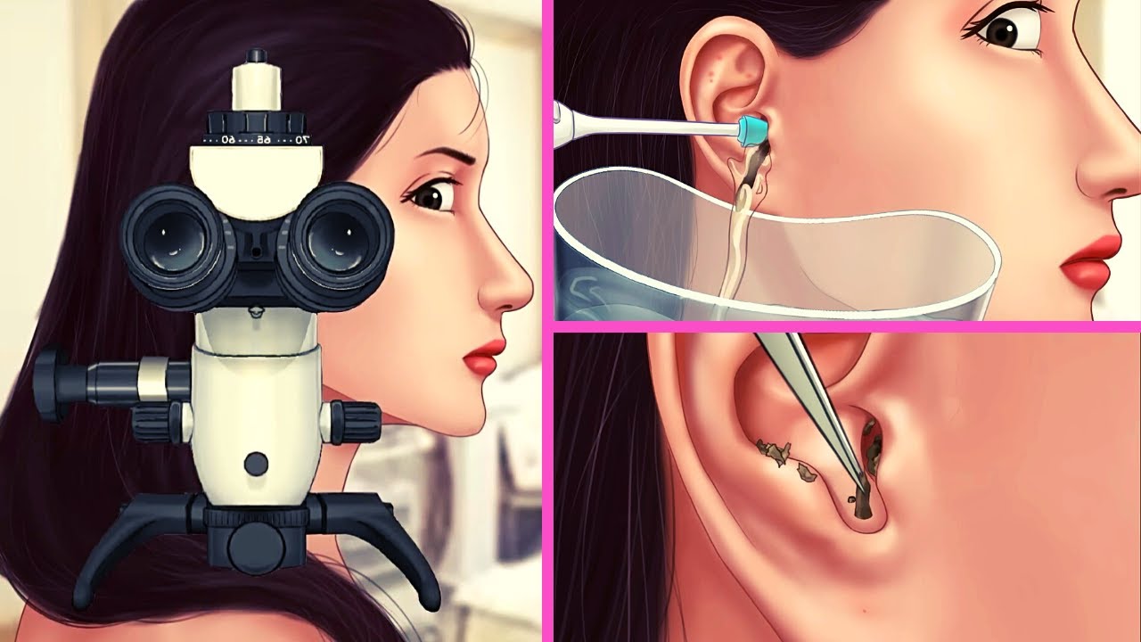 ASMR | Satisfying Ear Pimple Blackhead Care | Earwax Water Removal ...