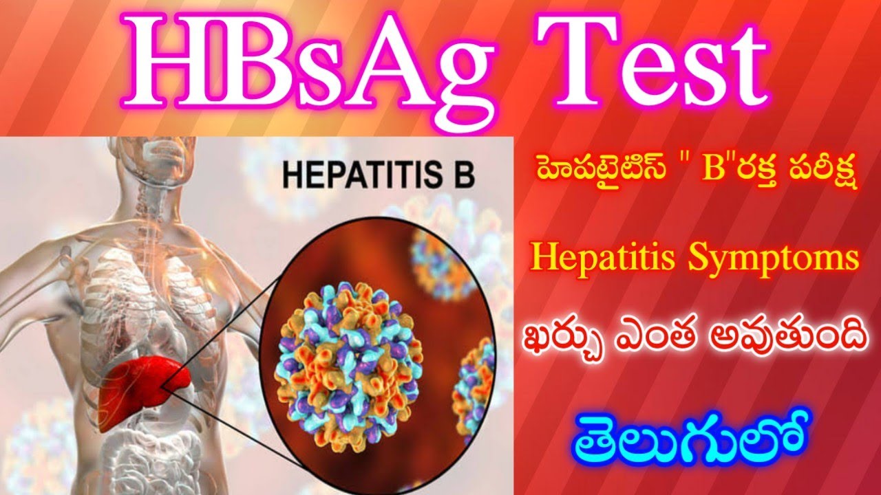 #HBsAg Test || హెపటైటిస్ B రక్త పరీక్ష || Hepatitis Symptoms || ఖర్చు ...