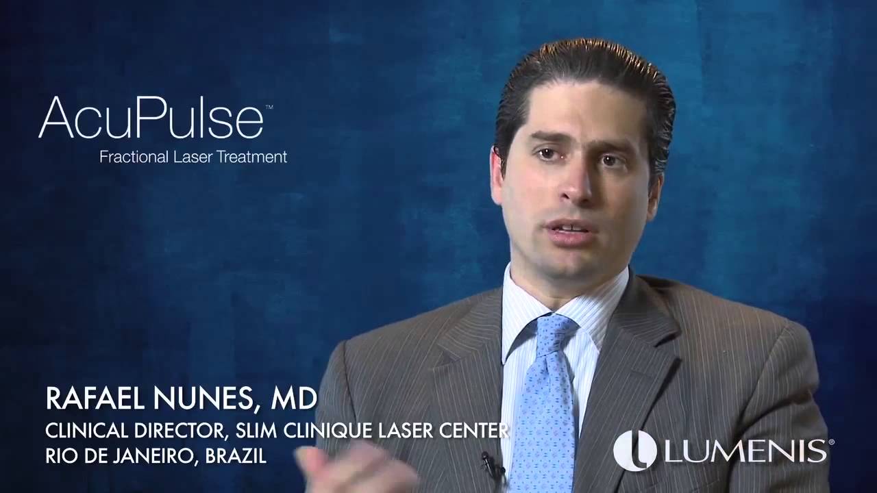Expert Perspectives: Rafael Nunes, MD, AcuPulse - YouTube