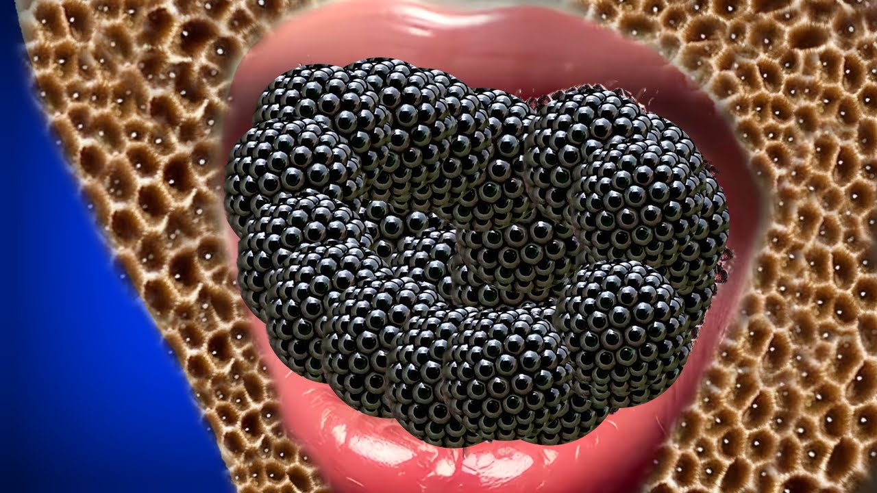 "Intense Parasite Removel Animation - ASMR Calm" - YouTube