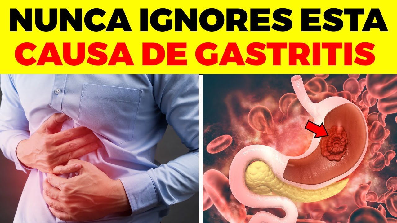 9 Razones Peligrosas por las que tienes GASTRITIS Y nadie te lo dice ...