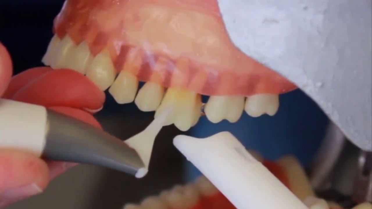 Periodontal Instrumentation: SUBGINGIVAL AIR POLISHING (Air-Flow Perio ...