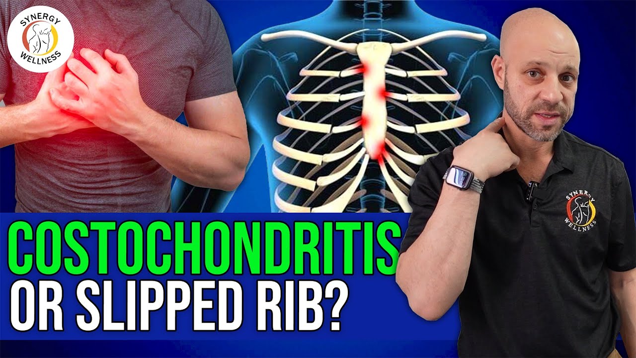 The SHOCKING Truth About Costochondritis and Slipping Rib Syndrome ...