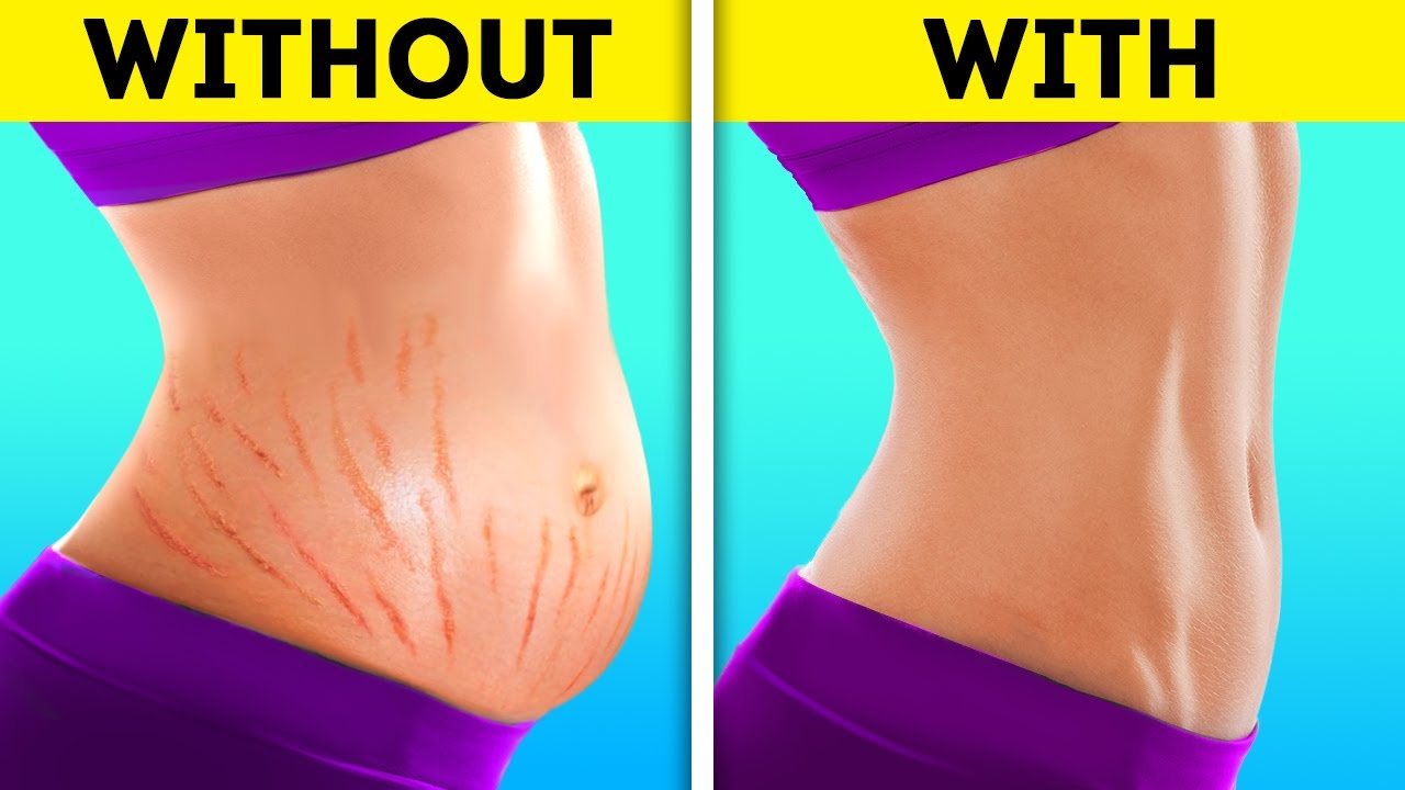23 BRILLIANT PREGNANCY HACKS TO STAY GORGEOUS - YouTube