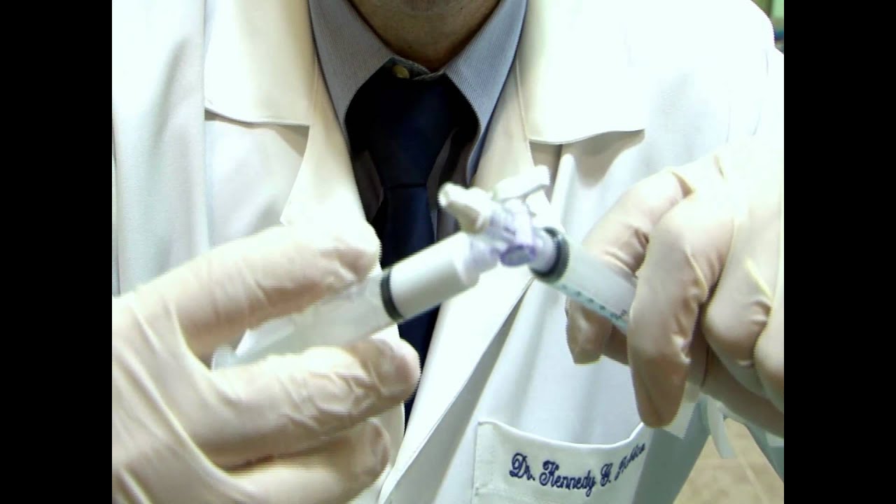 Aplicação de Espuma Densa nas pequenas varizes. Tratamento de varizes ...