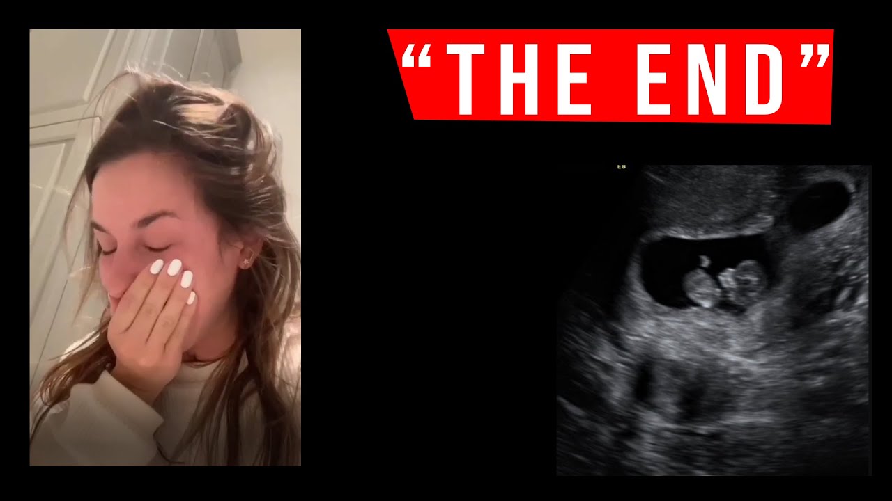 NF IS HAVING A BABY *WIFE'S LIVE REACTION* - YouTube
