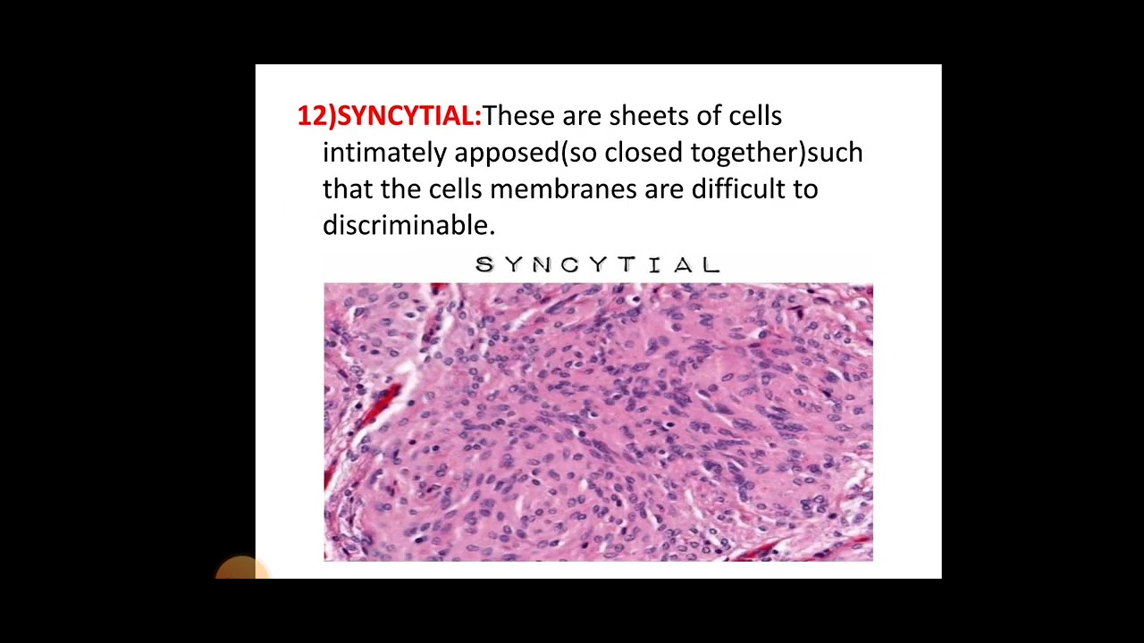 Morphological Patterns in HistoPathology - YouTube
