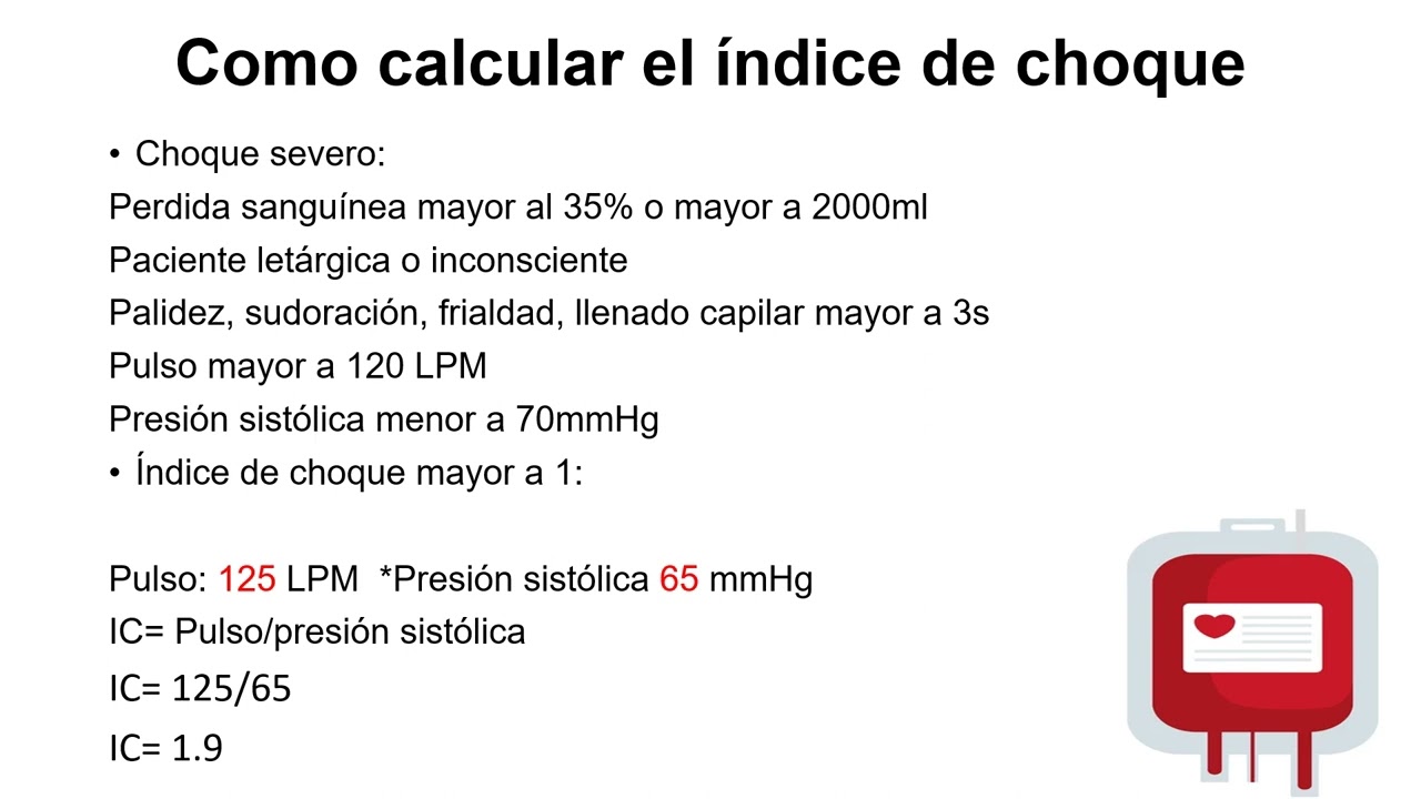 Índice de choque - YouTube