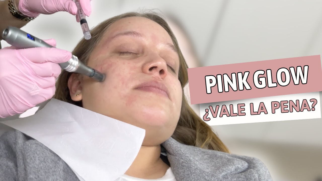 ¿FUNCIONA EL PINK GLOW PARA LA ROSÁCEA? | ANTES Y DESPUES - YouTube