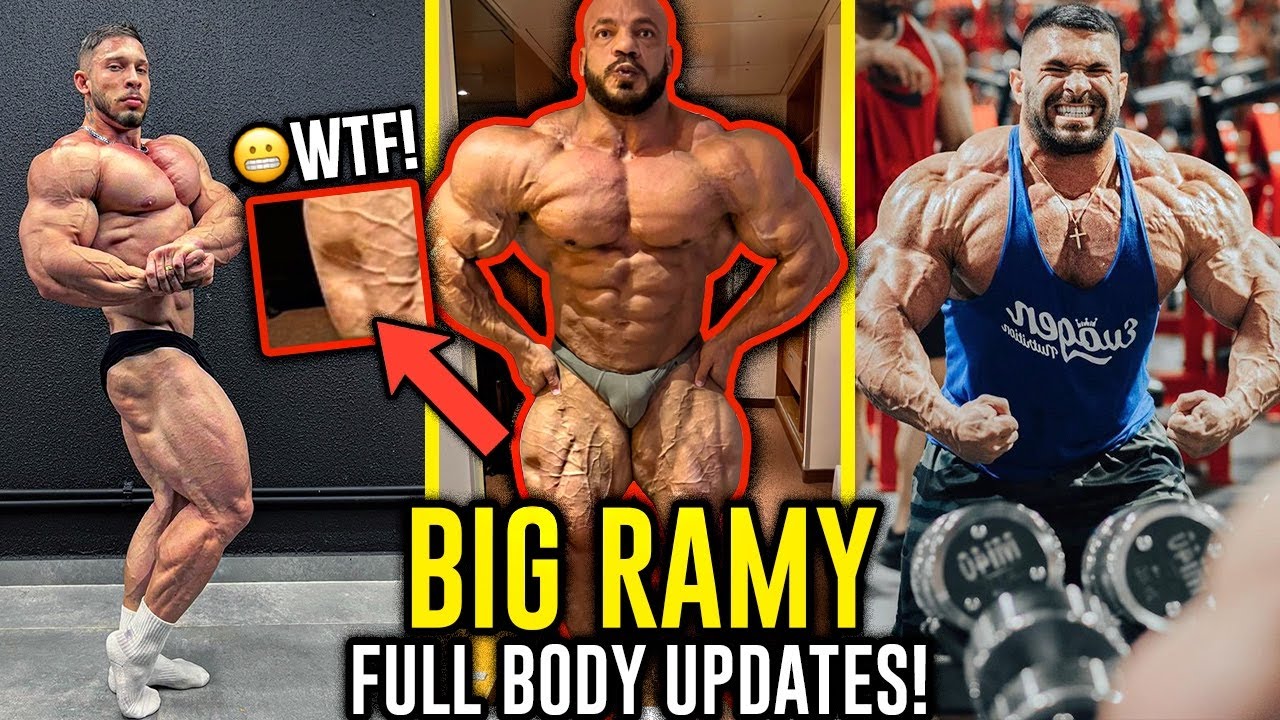 Big Ramy Hole In His Leg π Full Body Physique Update Walker Lunsford Ramon Vs Cbum Ii