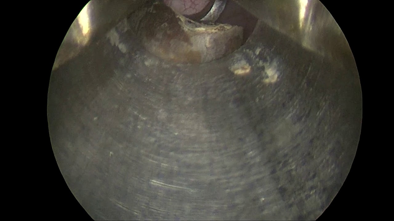 LITHOLAPAXY - YouTube