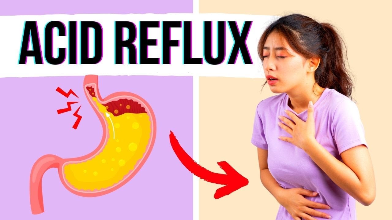How to Get Rid of Acid Reflux - Top 5 Best Working Home Remedies - YouTube