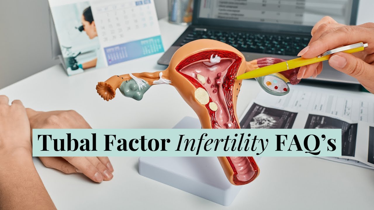 Tubal Factor Infertility FAQ’s - YouTube