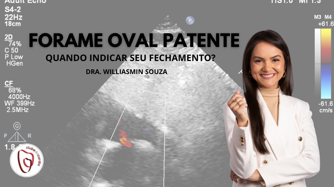 FORAME OVAL PATENTE (FOP): QUANDO INDICAR SEU FECHAMENTO? - YouTube