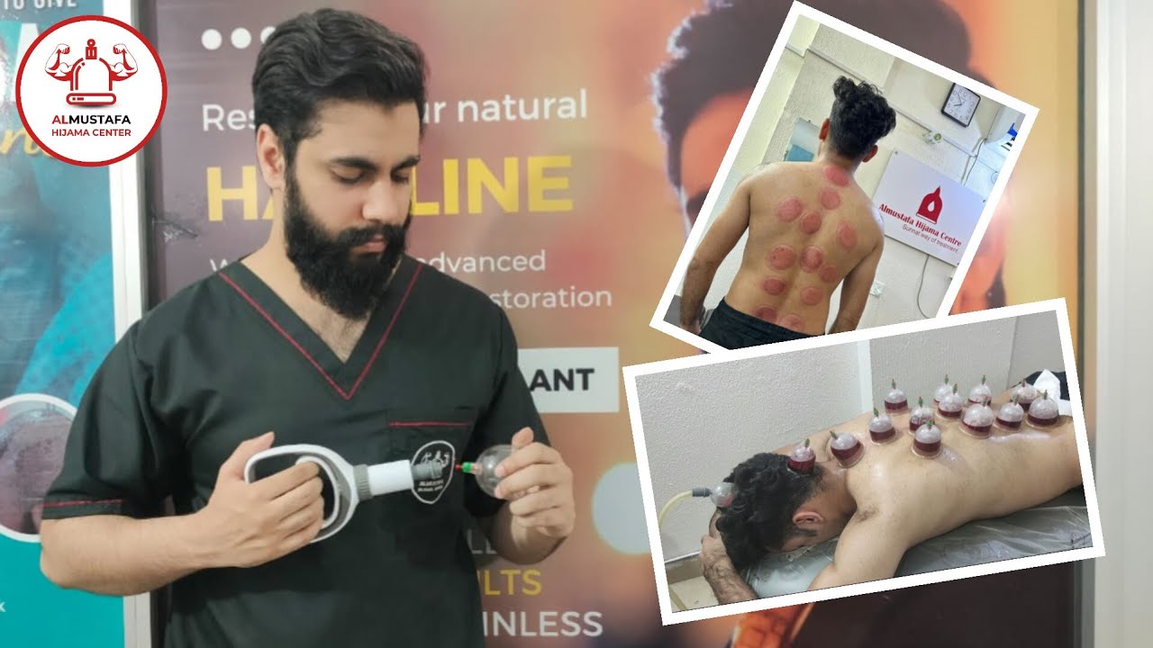 Treatment For Your Every Disease & Pain At Almustafa Hijama Center ️ ...