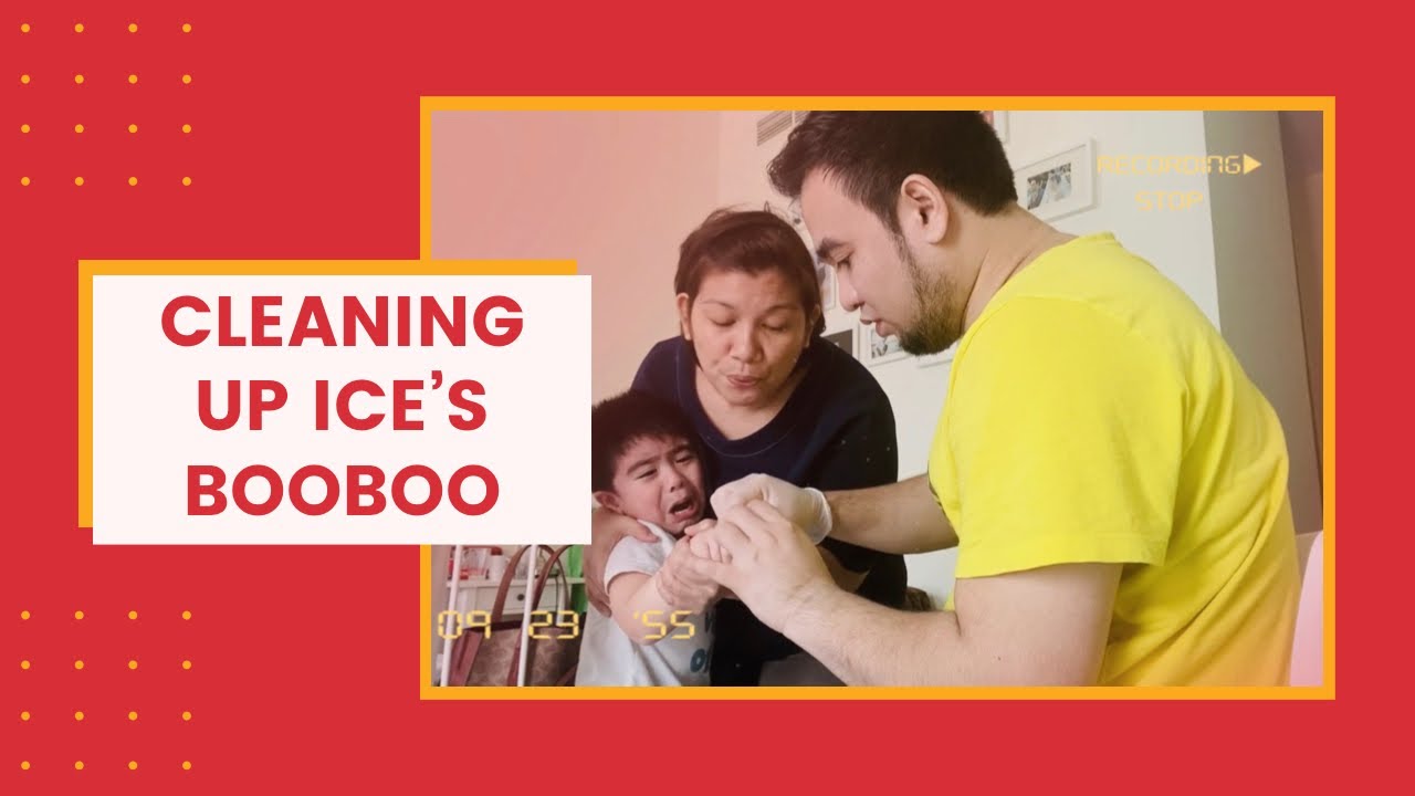 Cleaning Up my Baby’s Booboo Part 1 - YouTube