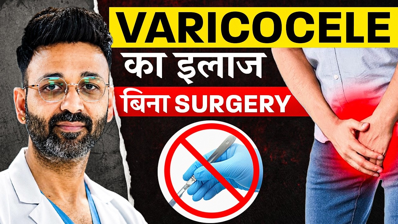Varicocele का बिना ऑपरेशन इलाज | Treatment Without Surgery | Varicocele ...